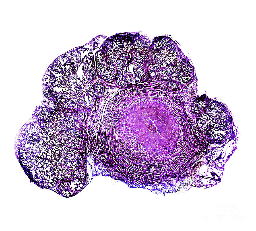 Prostate Gland System