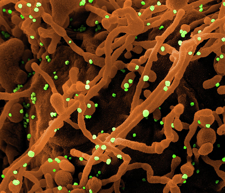 Sars-cov-2, Covid-19 Virus, Sem Photograph by Science Source - Pixels