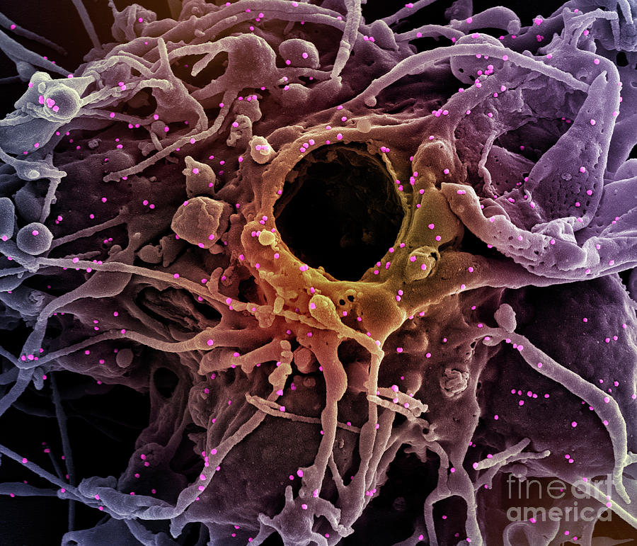 Cell Infected By Sars-cov-2 Virus Particles Photograph by National ...