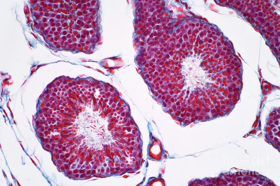 Human Testis Photograph By Choksawatdikorn Science Photo Library Pixels