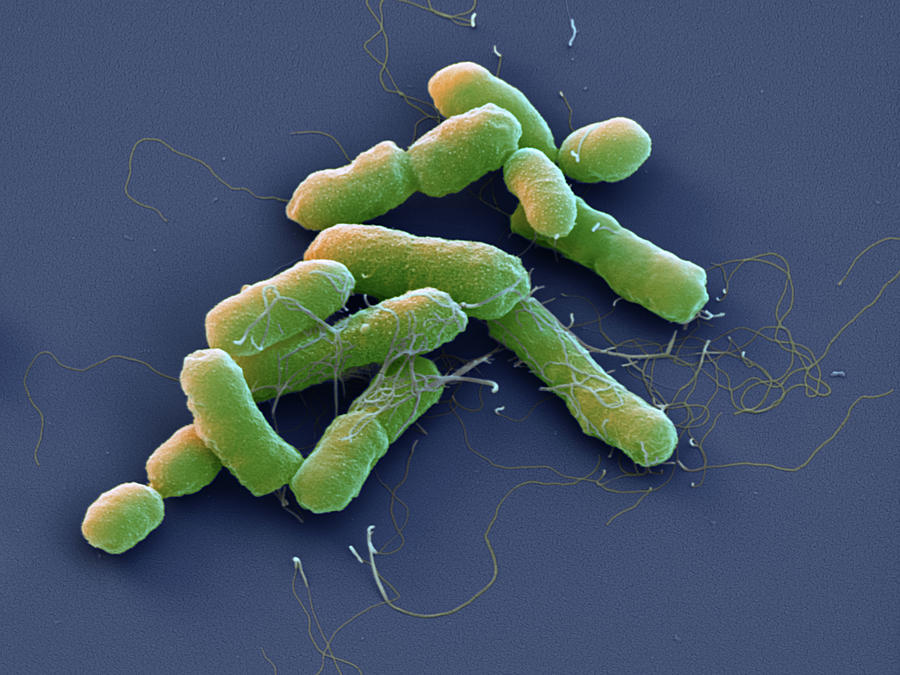 Proteus Mirabilis, Sem Photograph by Oliver Meckes EYE OF SCIENCE ...