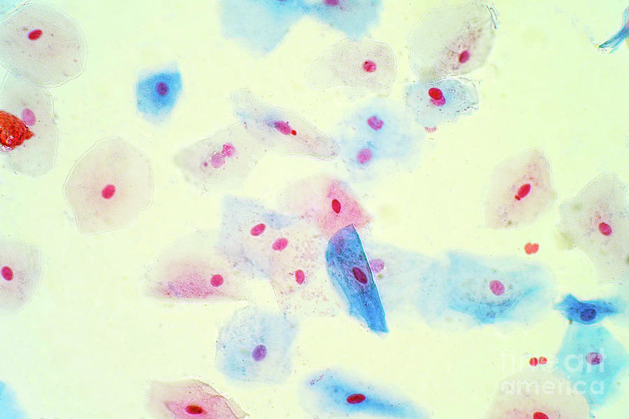 Squamous Epithelial Cells Photograph By Choksawatdikorn Science Photo