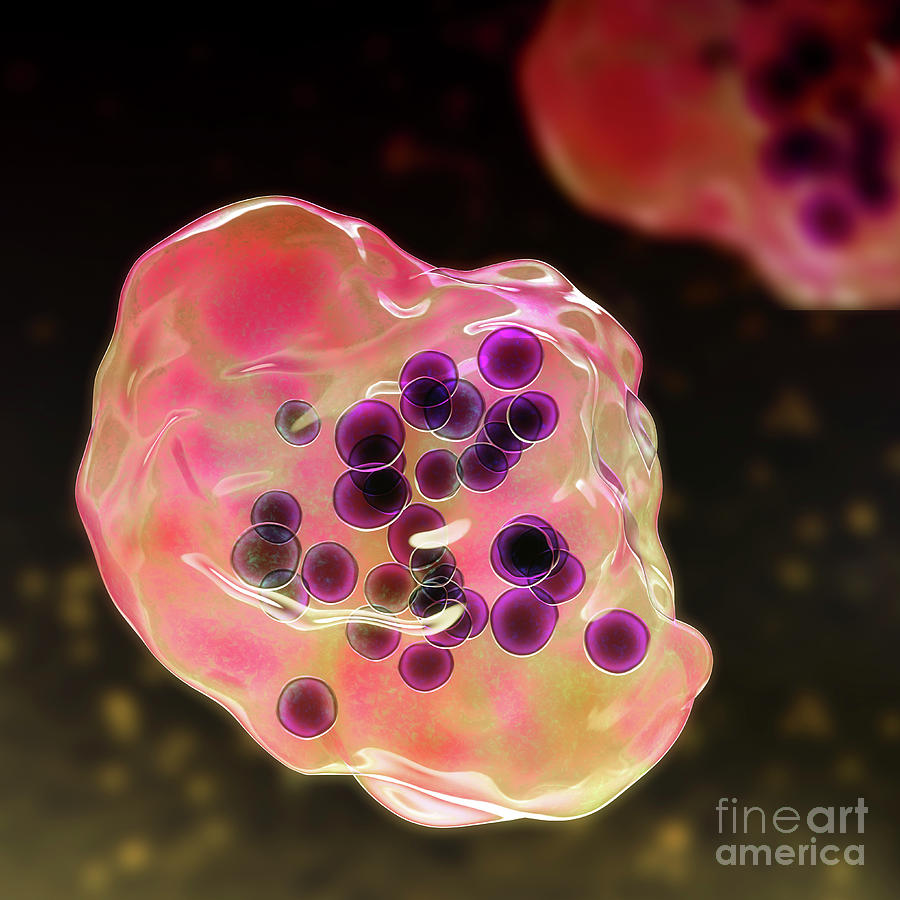 Measles Virus Infection Photograph by Kateryna Kon/science Photo Library | Pixels