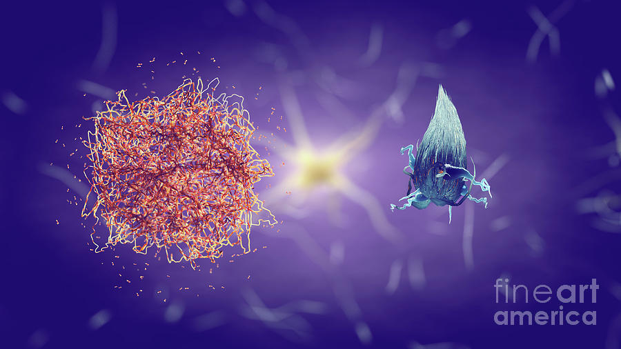 Amyloid Plaques In Alzheimer's Disease Photograph by Nobeastsofierce/science Photo Library ...