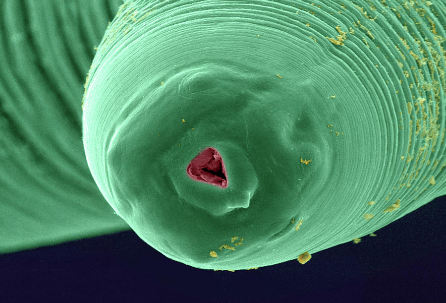 Anisakis Simplex, Parasitic Worm, Sem Photograph by Science Source ...