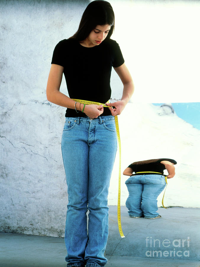 Anorexic Girls