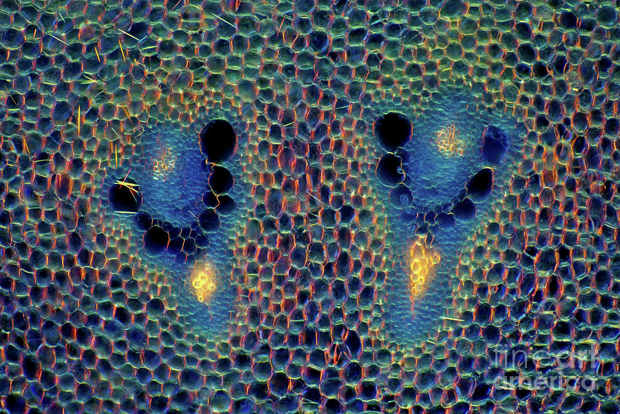 Asparagus Raphides And Vascular Bundles by Science Photo Library