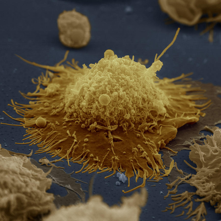 B-lymphocytes Photograph by Meckes/ottawa - Fine Art America