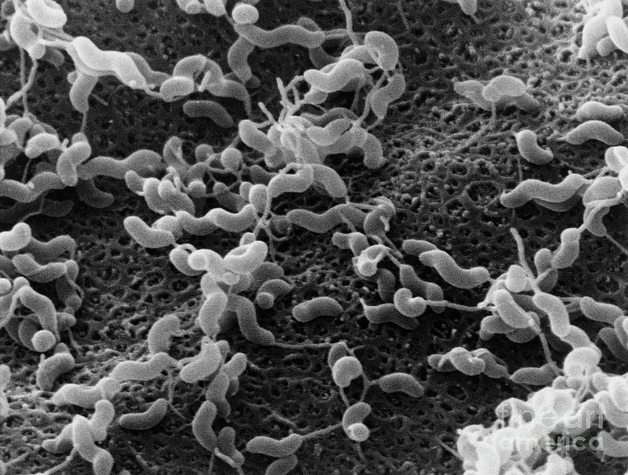 Campylobacter Jejuni Bacteria Photograph by Moredun Animal Health Ltd ...