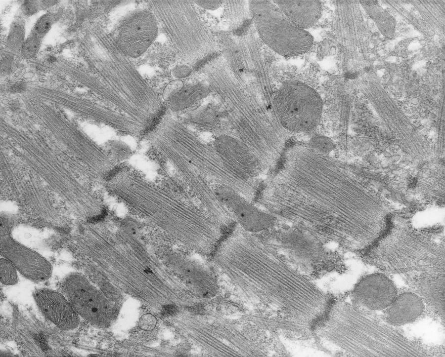 Cardiac Muscle Cells, Tem Photograph by David M Phillips - Fine Art America