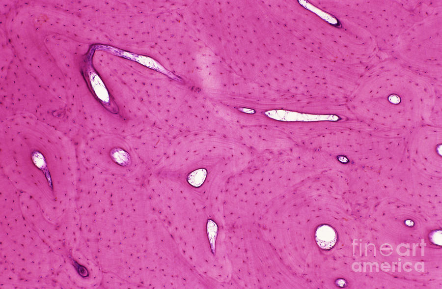 Compact Bone Photograph by Astrid & Hanns-frieder Michler/science Photo Library - Fine Art America