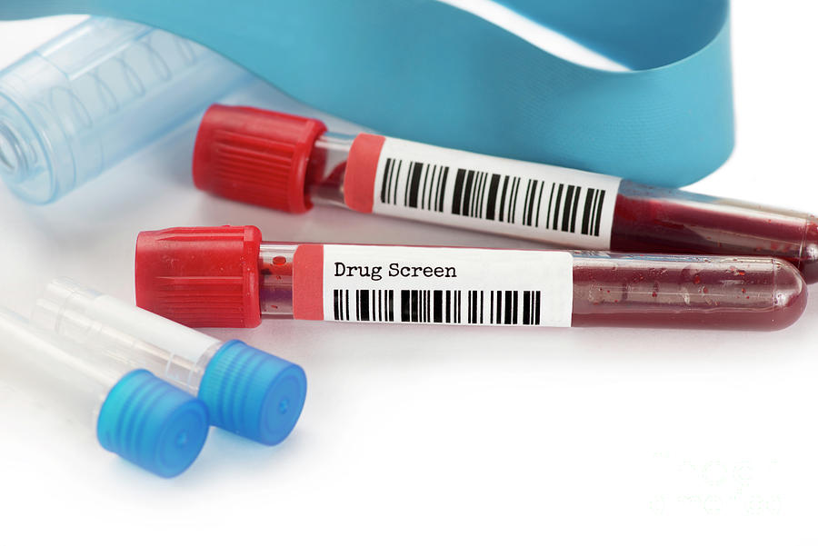 Drug Screen Blood Sample Photograph by Sherry Yates Young/science Photo ...