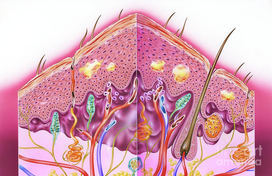 Eczema Photograph By John Bavosiscience Photo Library Pixels