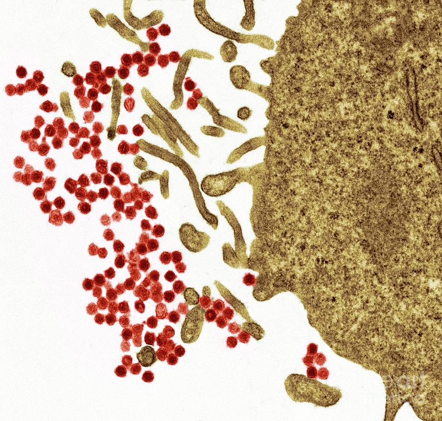Epstein-barr Virus Particles Photograph by Steve Gschmeissner/science ...