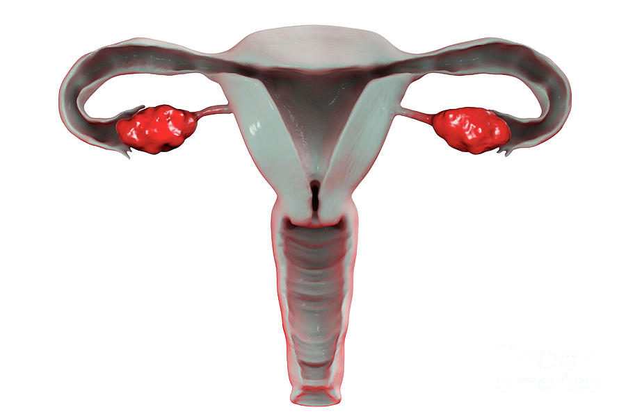 Female Reproductive System Photograph by Kateryna Kon/science Photo ...