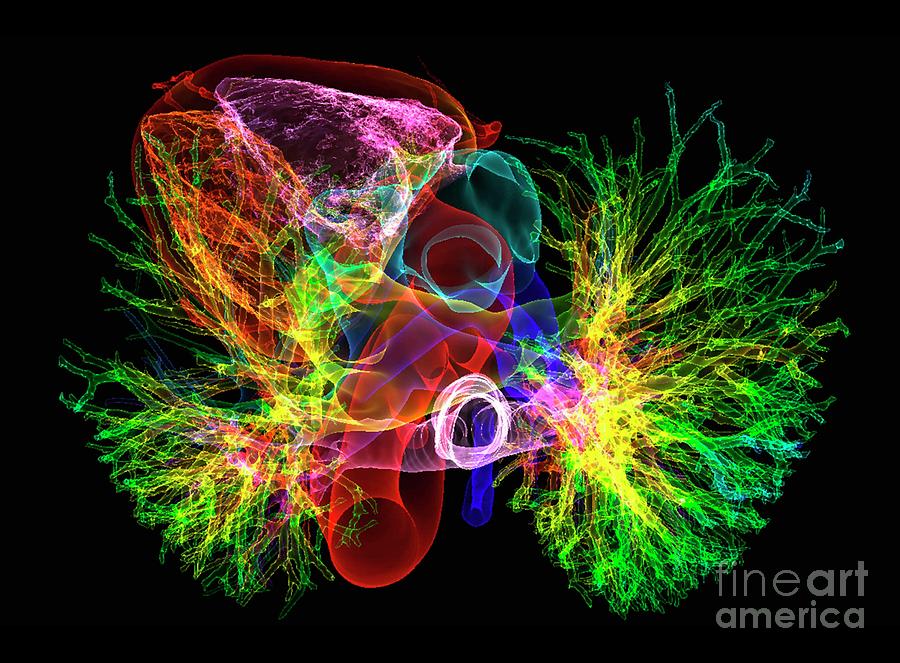 Healthy Heart And Lungs Photograph by K H Fung/science Photo Library ...