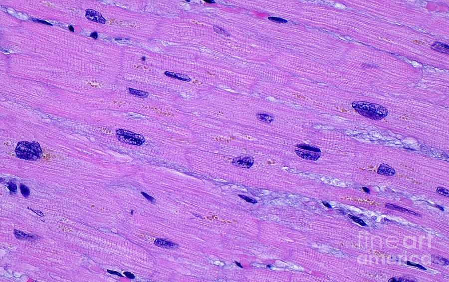 Cardiac Muscle Slide 400x