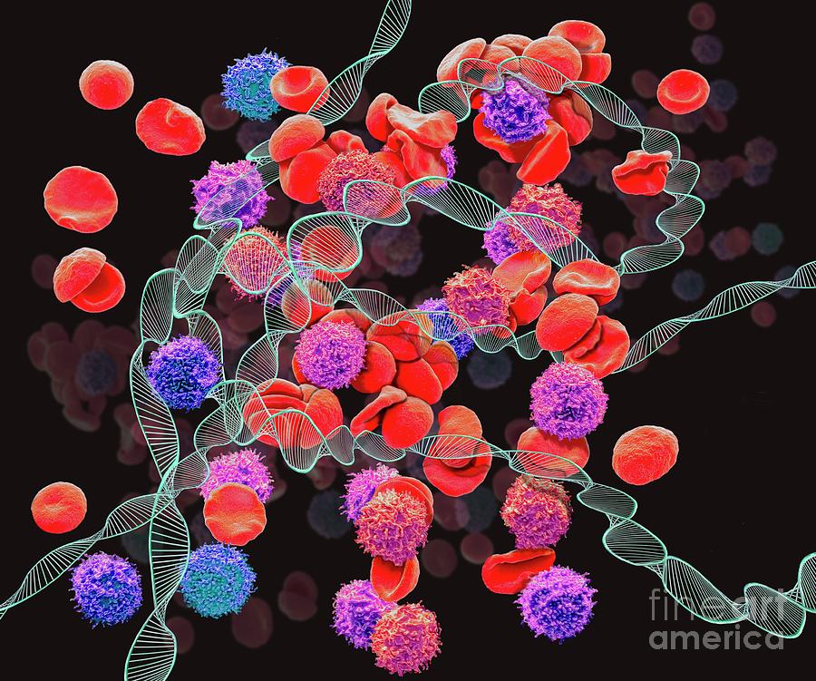 Leukaemia by Science Photo Library