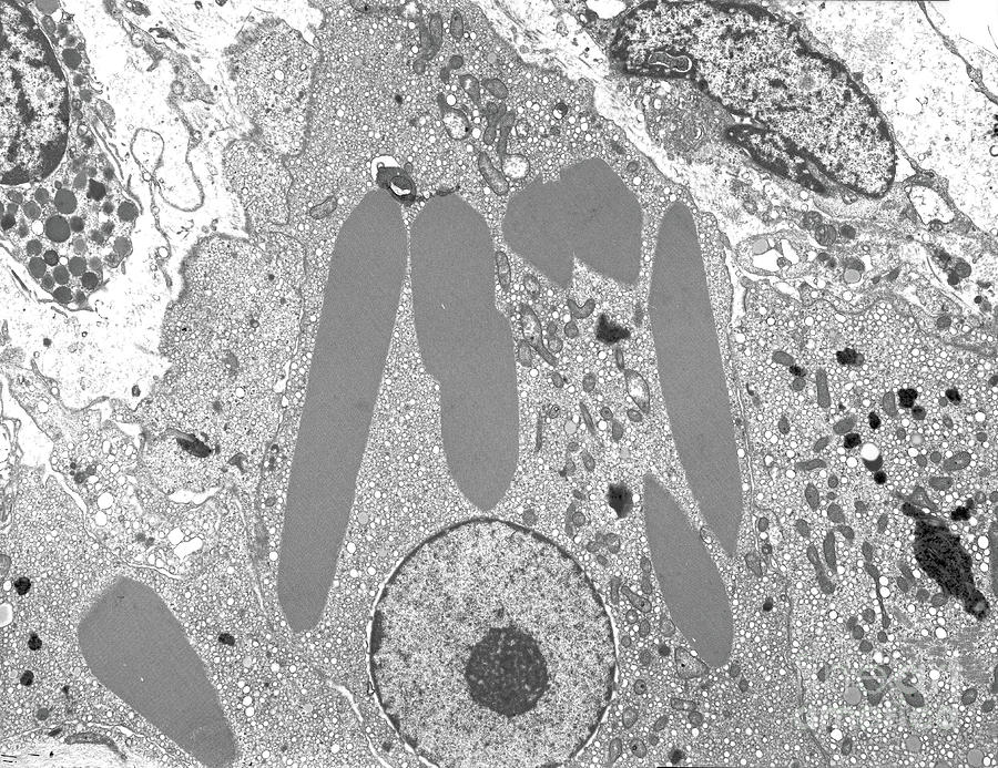 Leydig Cell Photograph By Microscape Science Photo Library Fine Art