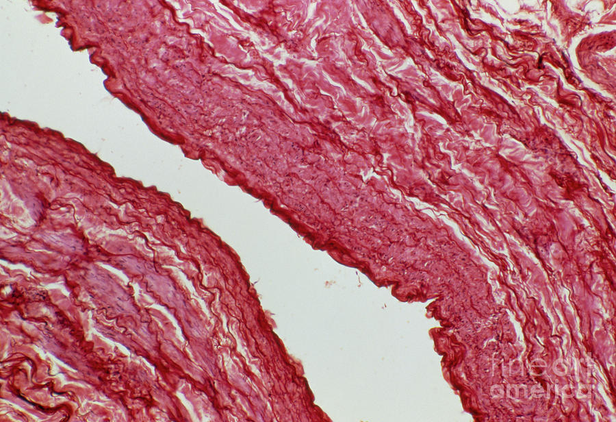 Lm Of A Longitudinal Section Of A Vein Photograph by Astrid & Hanns-frieder Michler/science ...