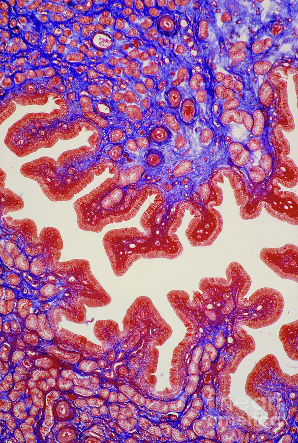 Lm Of A Section Through The Wall Of The Uterus Photograph by Astrid & Hanns-frieder Michler ...