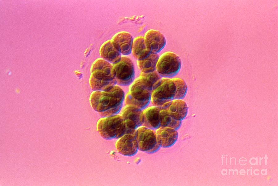 Lm Of Cells Of Freshwater Flagellate Photograph by Astrid & Hanns-frieder Michler/science Photo ...