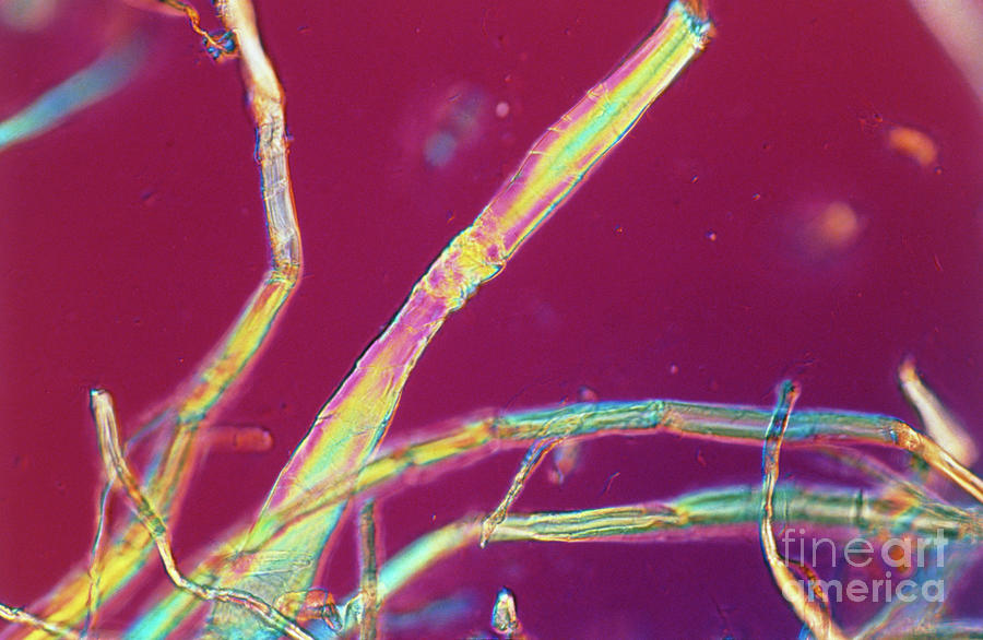 Lm Of Pure Cellulose Pine Fibres For Textiles Photograph by Astrid & Hanns-frieder Michler ...