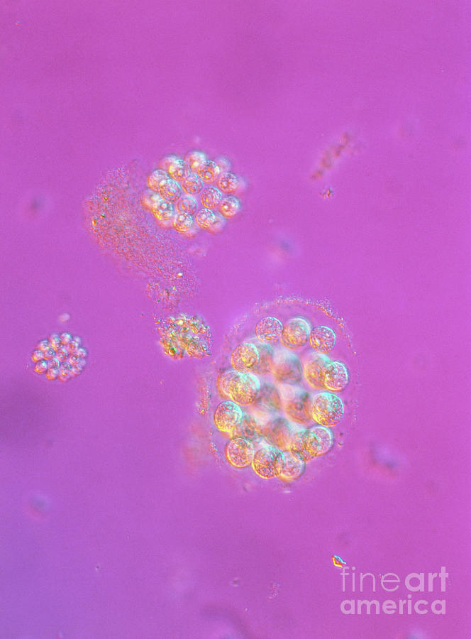 Lm Of Several Colonies Of Eudorina Photograph by Astrid & Hanns-frieder Michler/science Photo ...