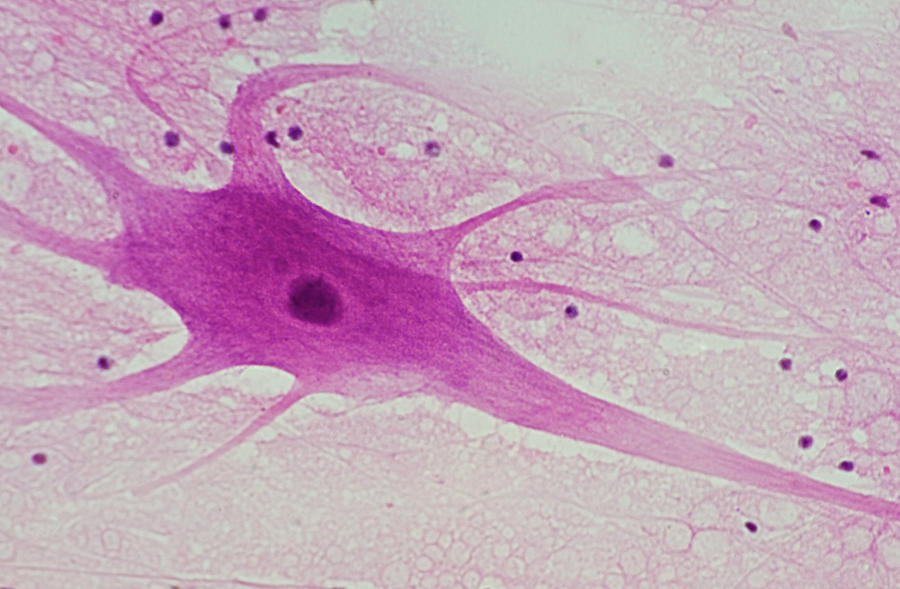 Multipolar Neuron Motor Cell Body By Ed Reschke