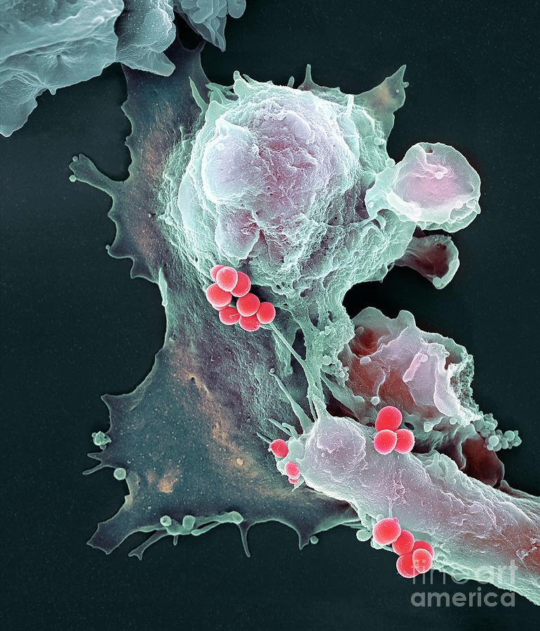 Neutrophil Engulfing Staphylococcus Aureus Bacteria Photograph by ... Neutrophil Engulfing Staphylococcus Aureus Bacteria Photograph by ...