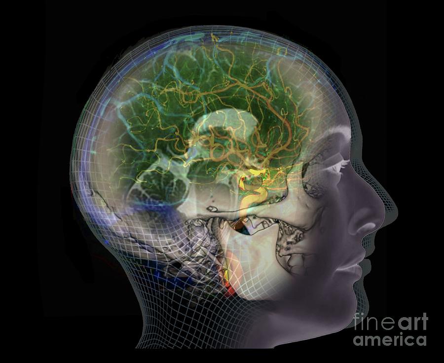 Normal Brain And Skull Photograph by Science Photo Library - Pixels