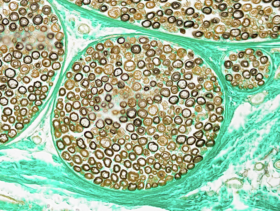 Peripheral Nerve by Science Photo Library