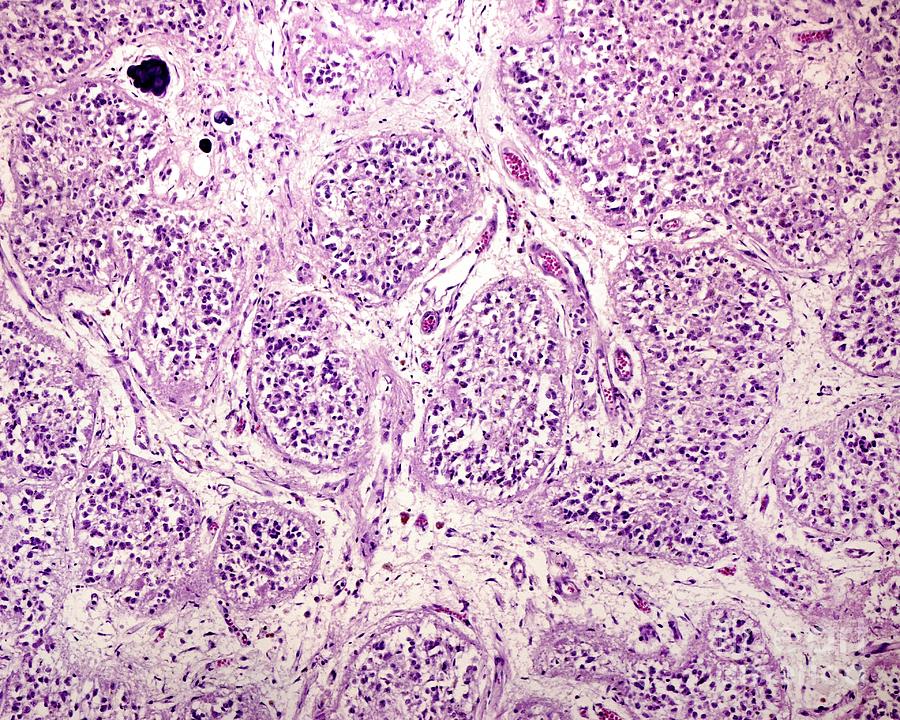 Pineal Gland Lobulation by Science Photo Library