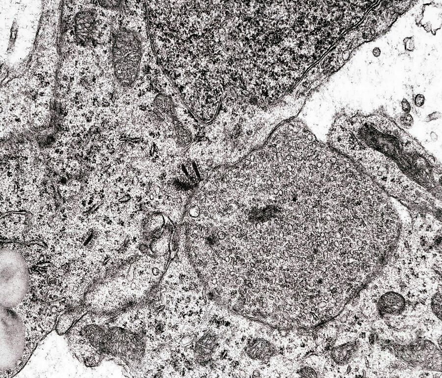 Pinealocyte Synaptic Ribbons by Jose Calvo / Science Photo Library