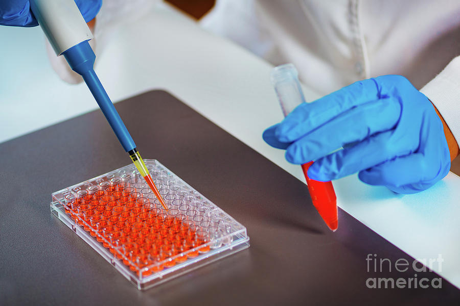 Pipetting Sample by Science Photo Library