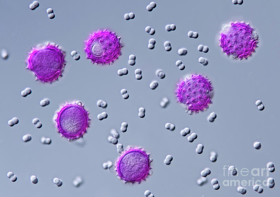 Pollen Grains Size Comparison Preparation Photograph By Gerd Guentherscience Photo Library Pixels