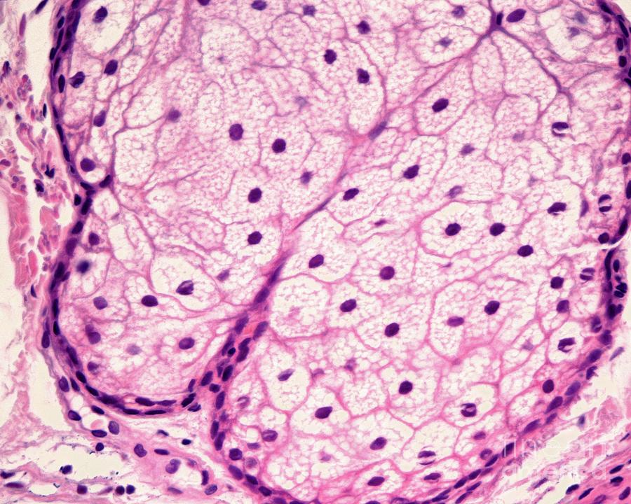 Sebaceous Gland Photograph By Jose Calvo Science Photo Library Pixels