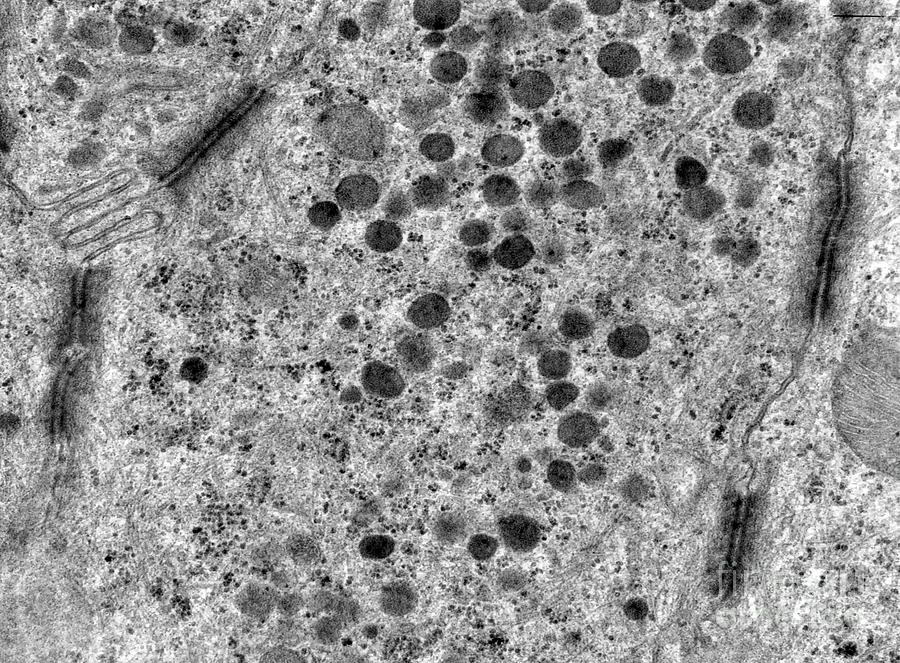 Secretory Cell With Desmosomes by Science Photo Library