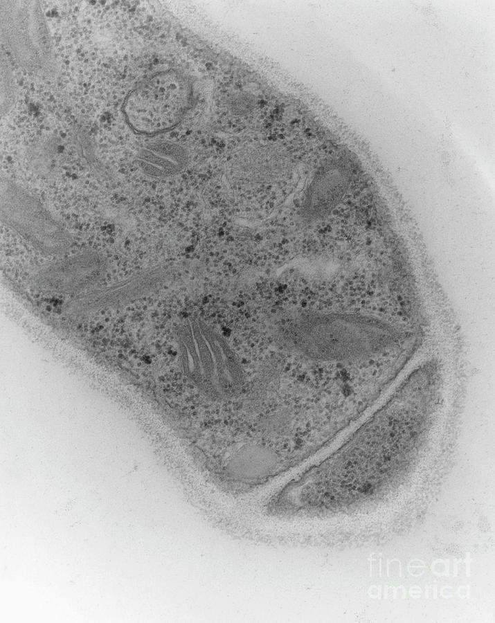 Section Through Trichoderma Reesei Fungus Photograph by Dr Kari Lounatmaa/science Photo Library ...