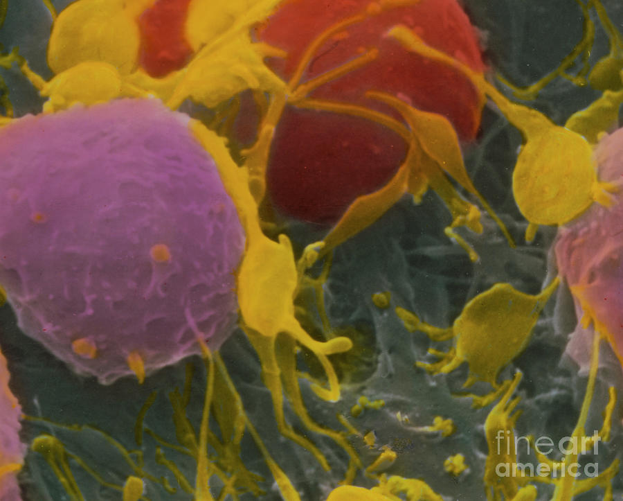 Sem Of Activated Platelets In Human Blood Photograph by Professor P.m. Motta, G. Macchiarelli, S ...