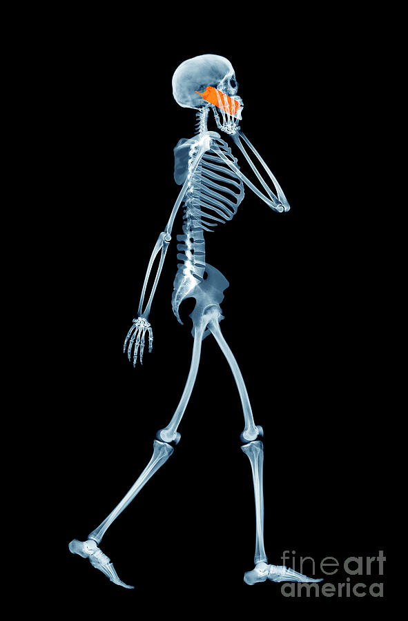Skeleton Using A Mobile Phone Photograph by D. Roberts/science Photo ...