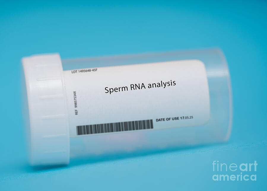 Sperm Rna Analysis by Wladimir Bulgar/science Photo Library
