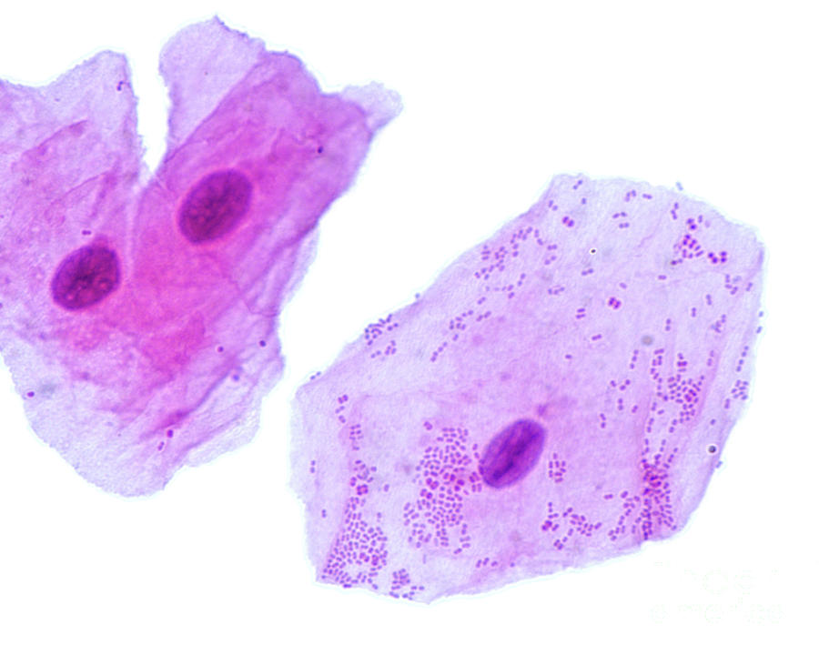 Squamous Epithelial Cells By Jose Calvo Science Photo Library