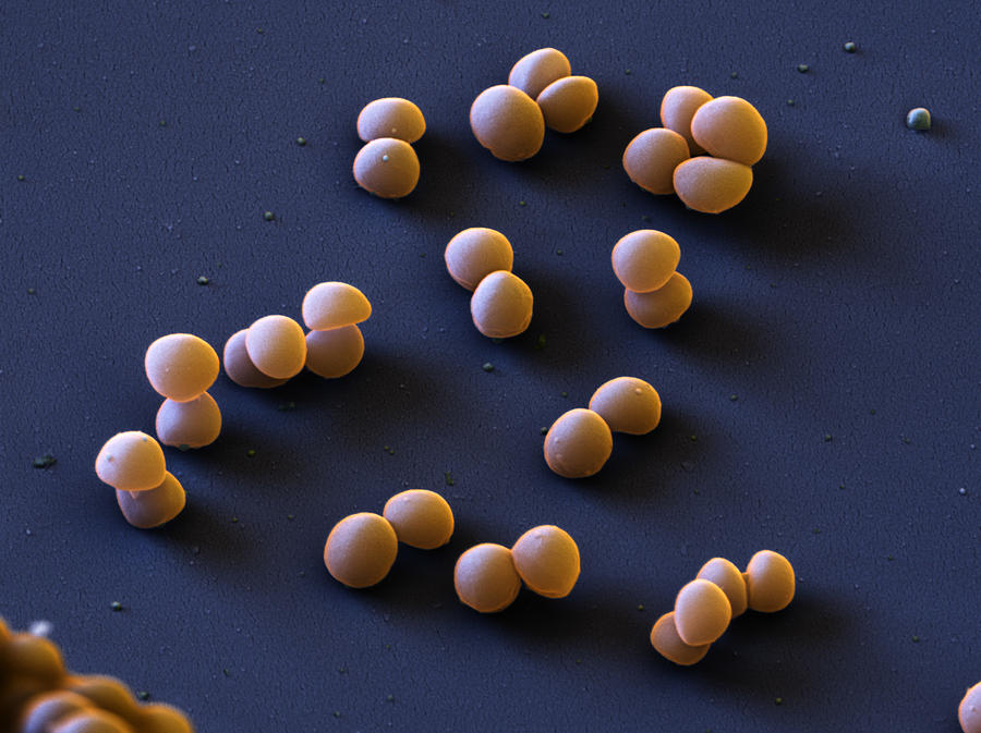 Staphylococcus Lugdunensis, Sem Photograph by Meckes/ottawa - Fine Art ...