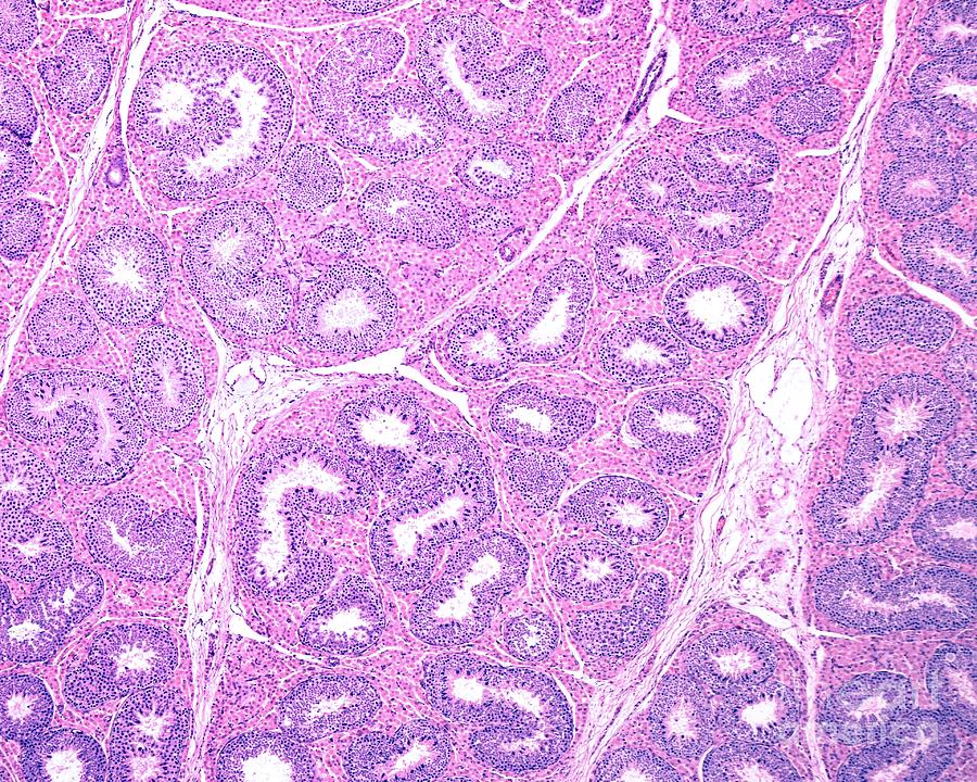 Testicular Lobules Photograph by Science Photo Library - Fine Art America