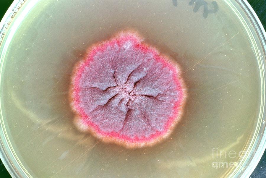 Trichophyton Violaceum Fungus In Culture Photograph by John Durham ...