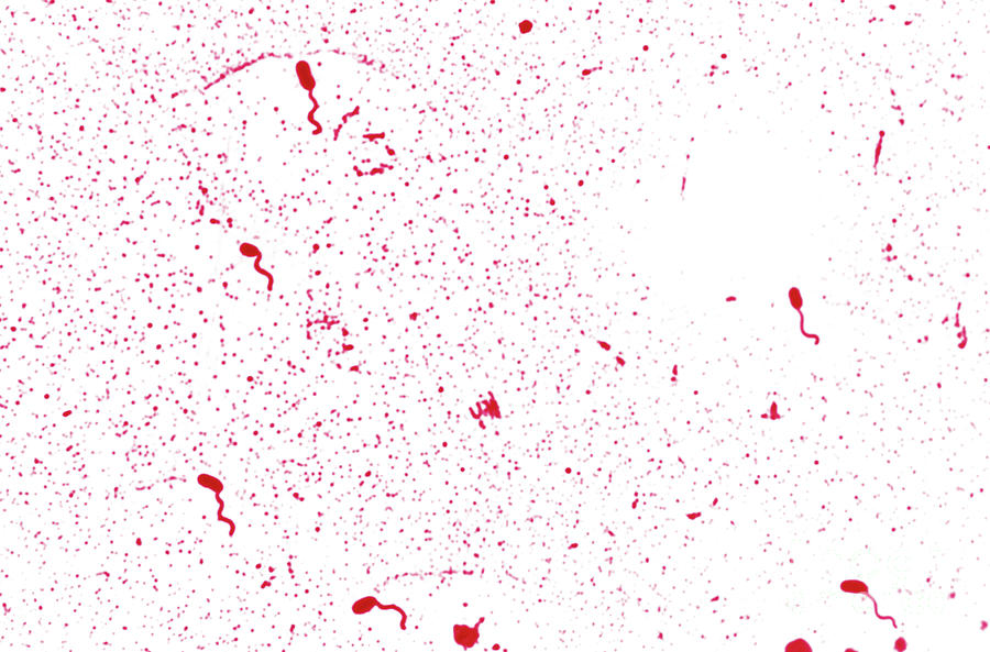 Vibrio Cholerae Photograph by Cdc/science Photo Library - Fine Art America