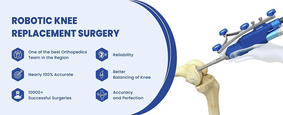 Best Robotic Knee Replacement Surgery Mixed Media by Anoop - Fine Art ... Best Robotic Knee Replacement Surgery Mixed Media by Anoop - Fine Art ...