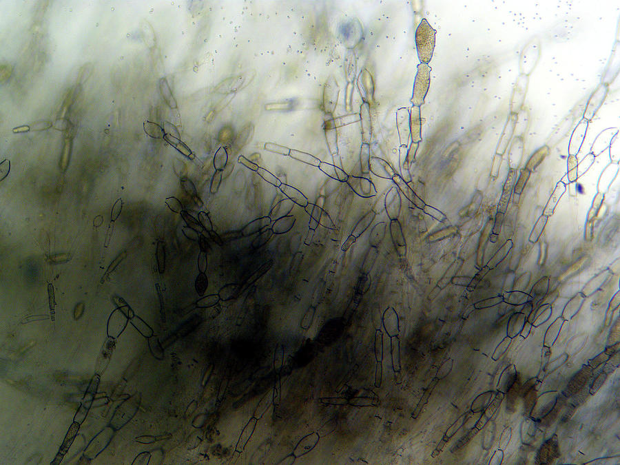 Microscopy Mold Spores Photograph by James Richmond - Fine Art America