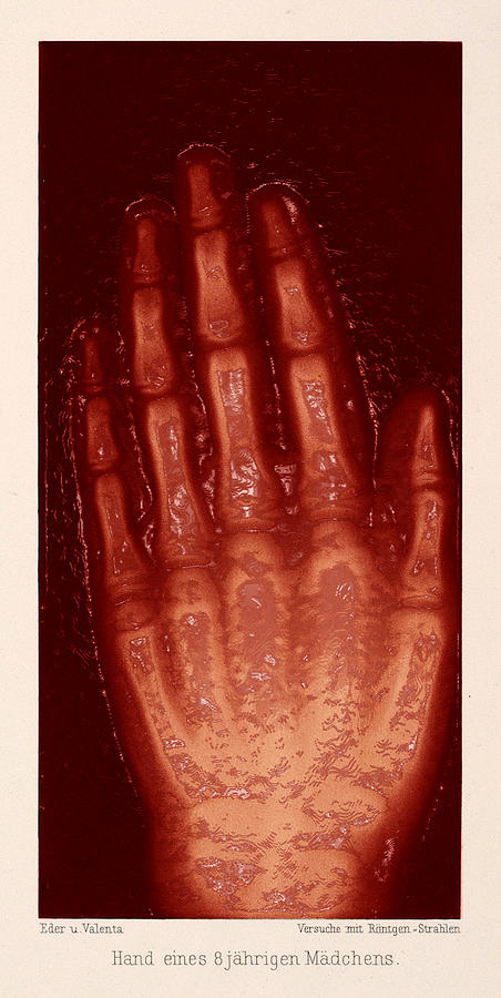 Vintage X-Ray Hand Photograph by Mark Gantt - Pixels